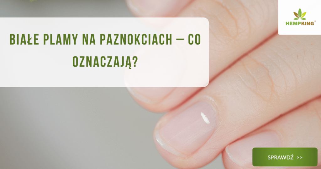 Białe plamy na paznokciach - co oznaczają? | Blog HempKing