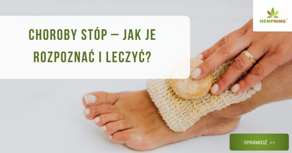 Choroby stóp – jak je rozpoznać i leczyć - Blog HempKing